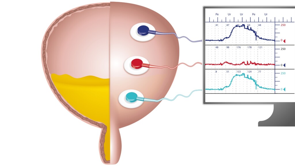 Urodynamic Testing