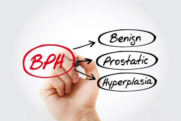 Enlarged Prostate: Understanding Benign Prostatic Hyperplasia